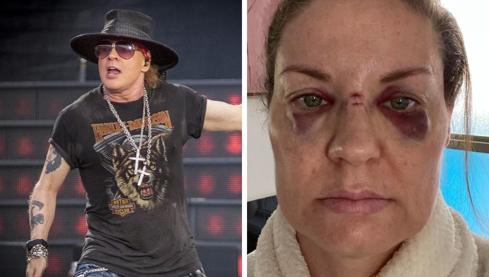 Aussie woman injured after being hit by a mic at Guns N' Roses concert