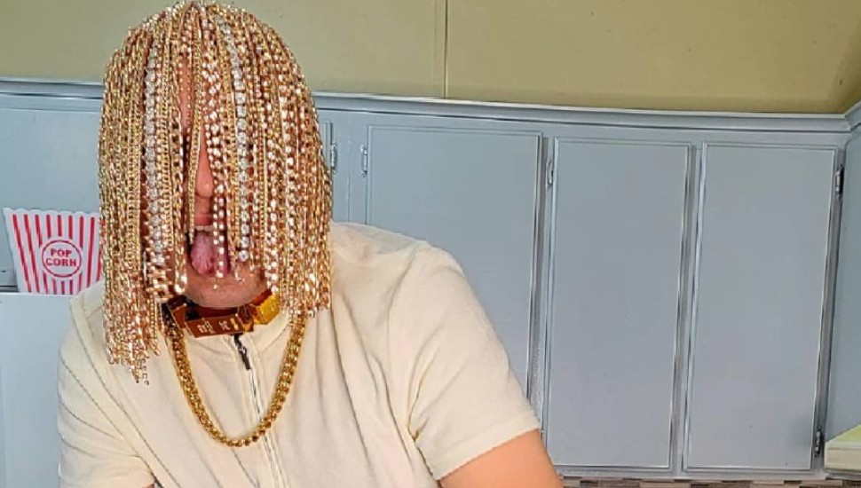Rapper Dan Sur gets gold chains surgically implanted into his scalp