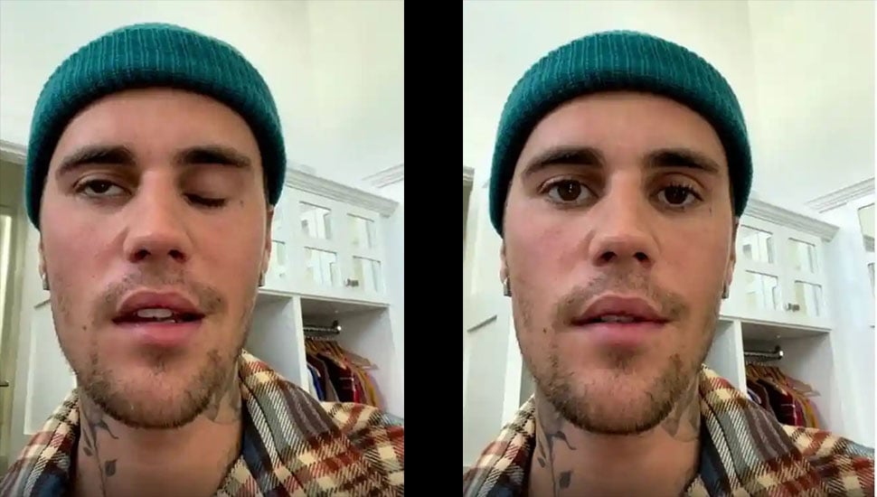 Justin Bieber reveals rare medical diagnosis