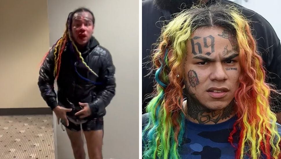 Tekashi 6ix9ine hospitalised after savage attack